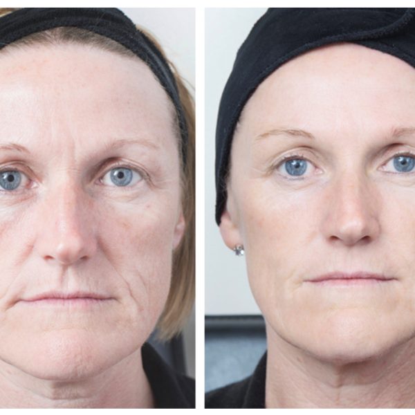 CLINICAL COMCIT TDO - Crystal Clear Clinical